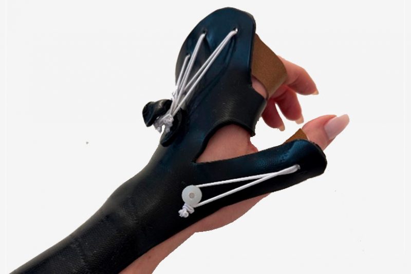 Schienenversorgung: Schienen für Hand, Finger, Arm in Ulm